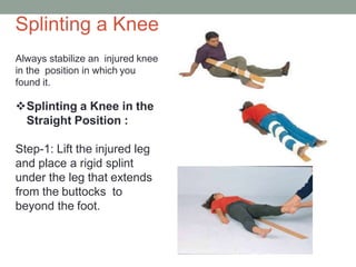 Splinting in sports | PPT