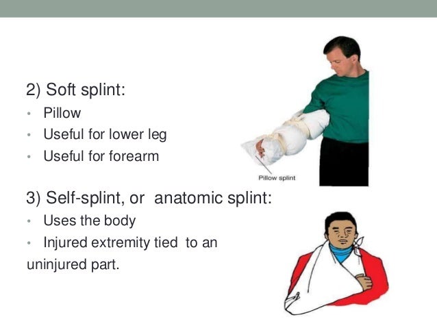 Splinting in sports