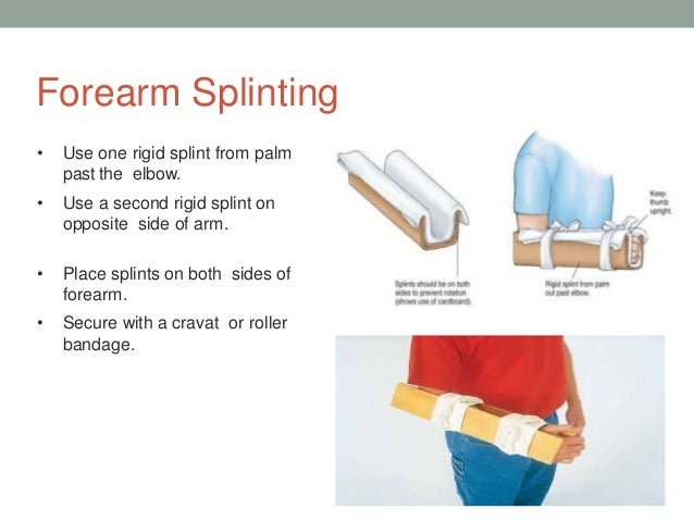 Splinting in sports
