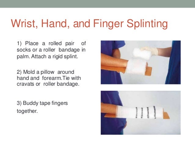 Splinting in sports
