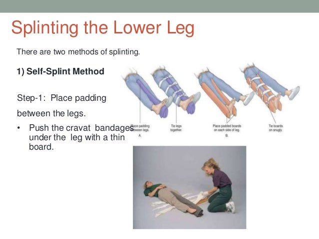 Splinting in sports
