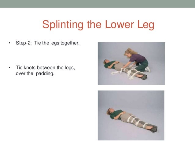 Splinting in sports