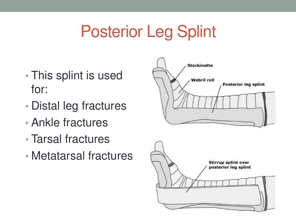 Splinting in sports