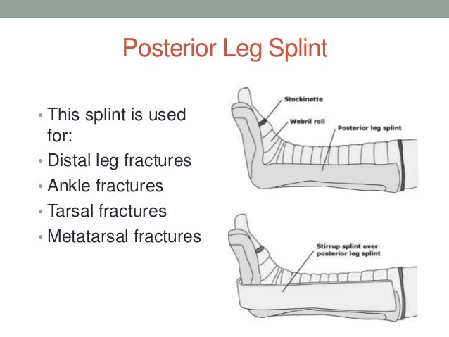 Splinting in sports