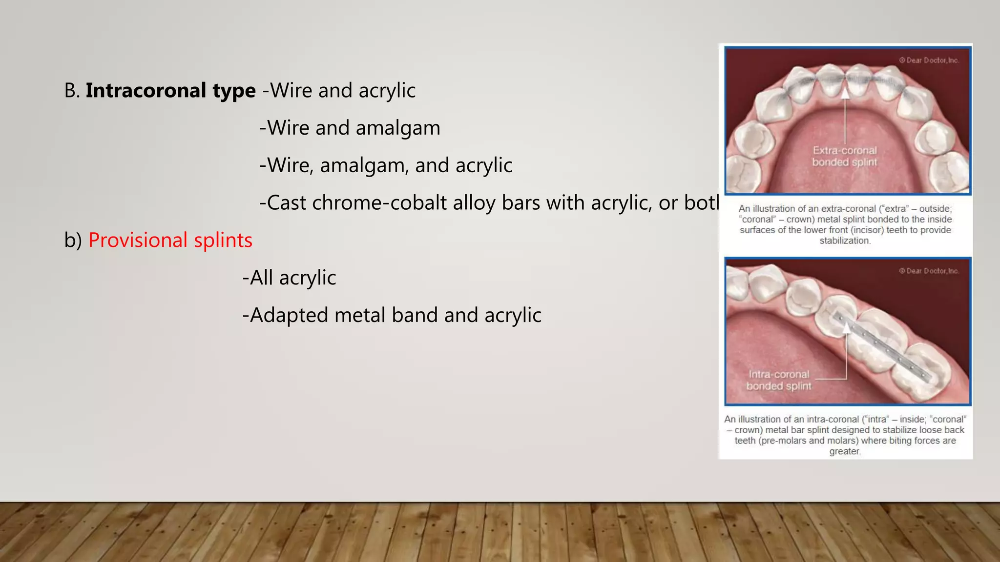 Splinting of traumatized teeth | PPTX