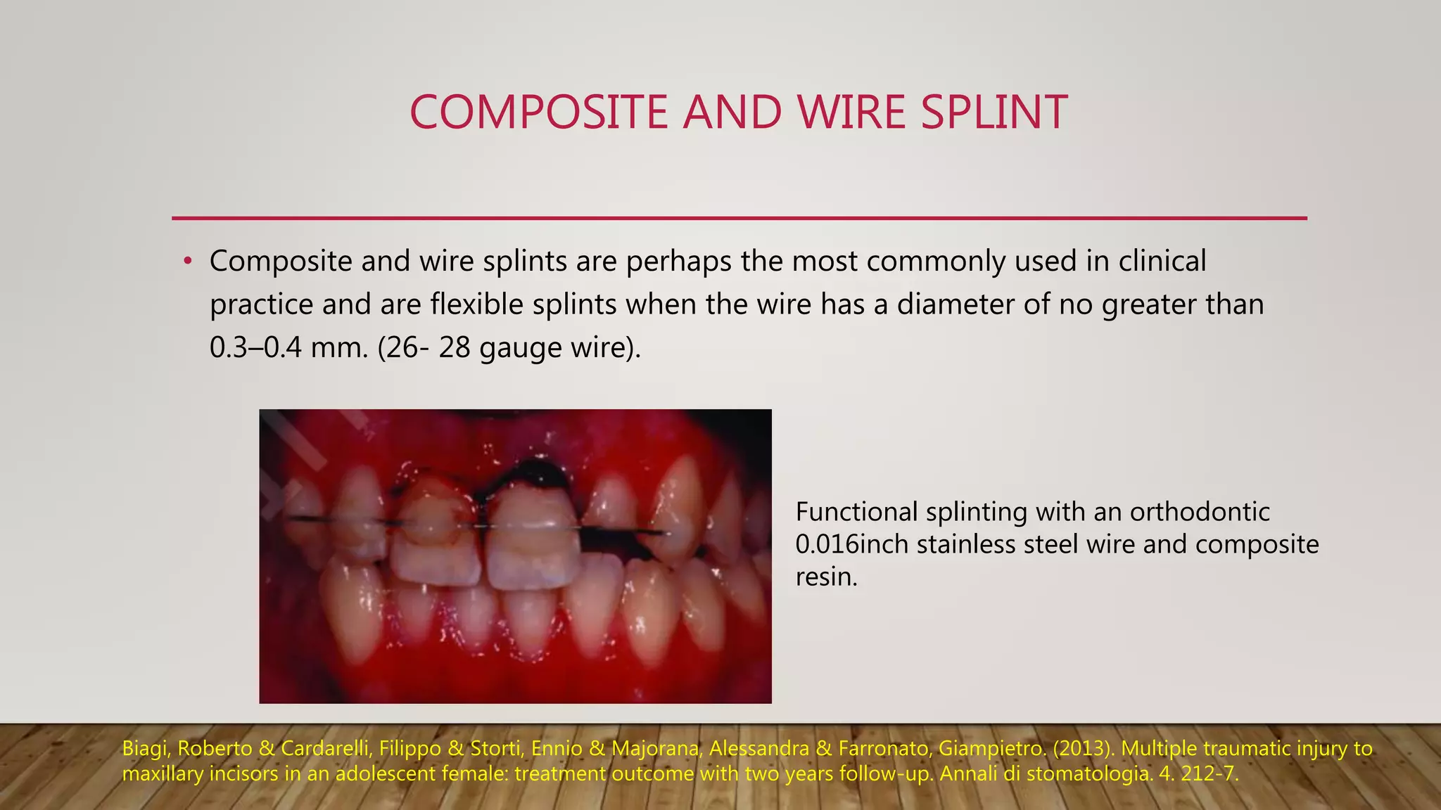 Splinting of traumatized teeth | PPTX