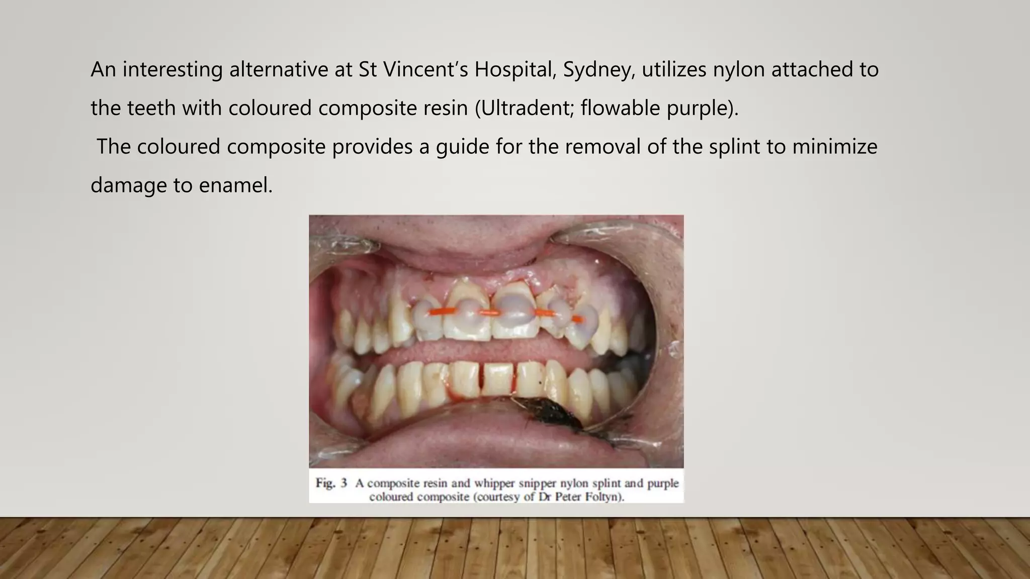 Splinting of traumatized teeth | PPTX