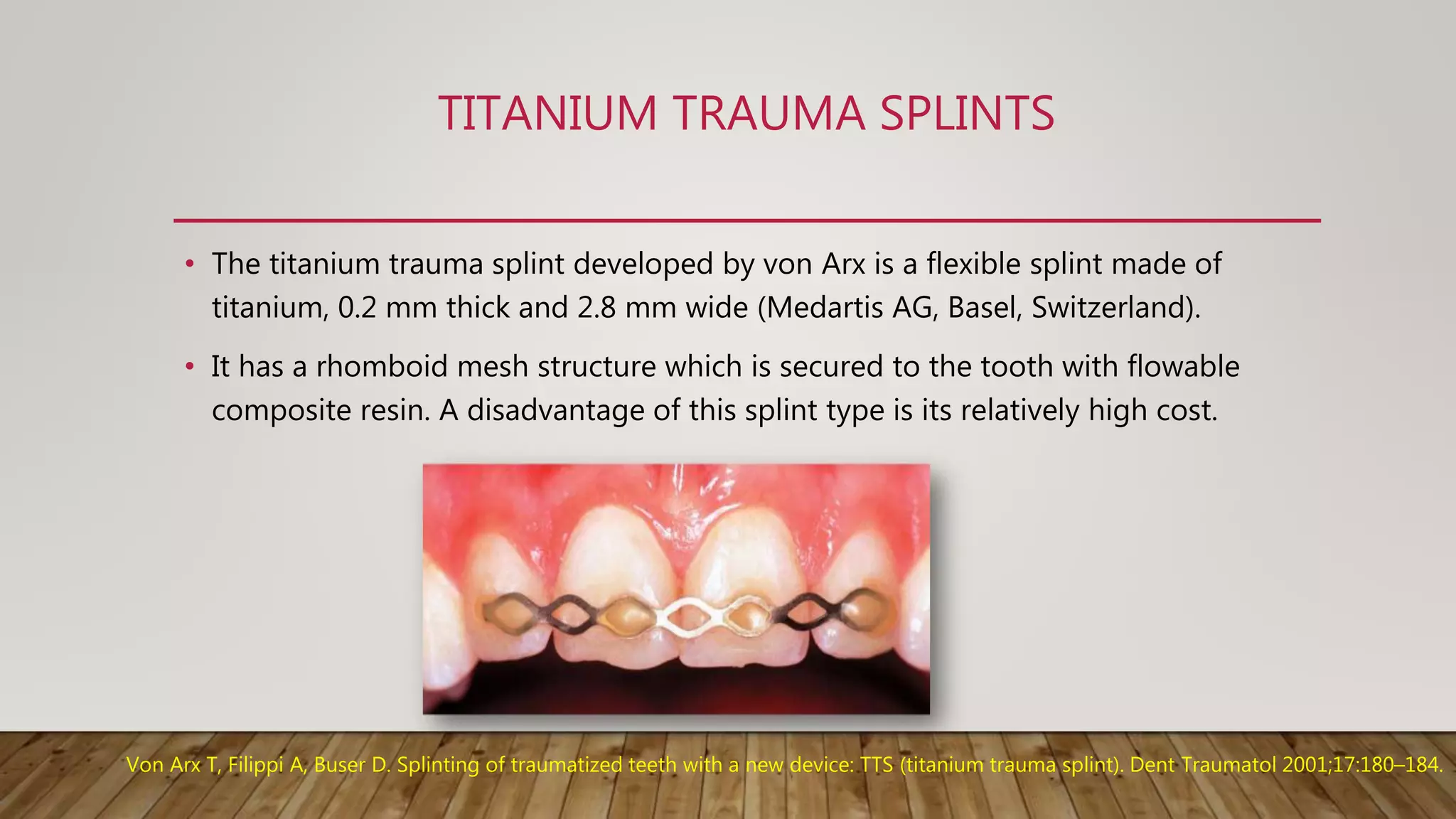 Splinting of traumatized teeth | PPTX