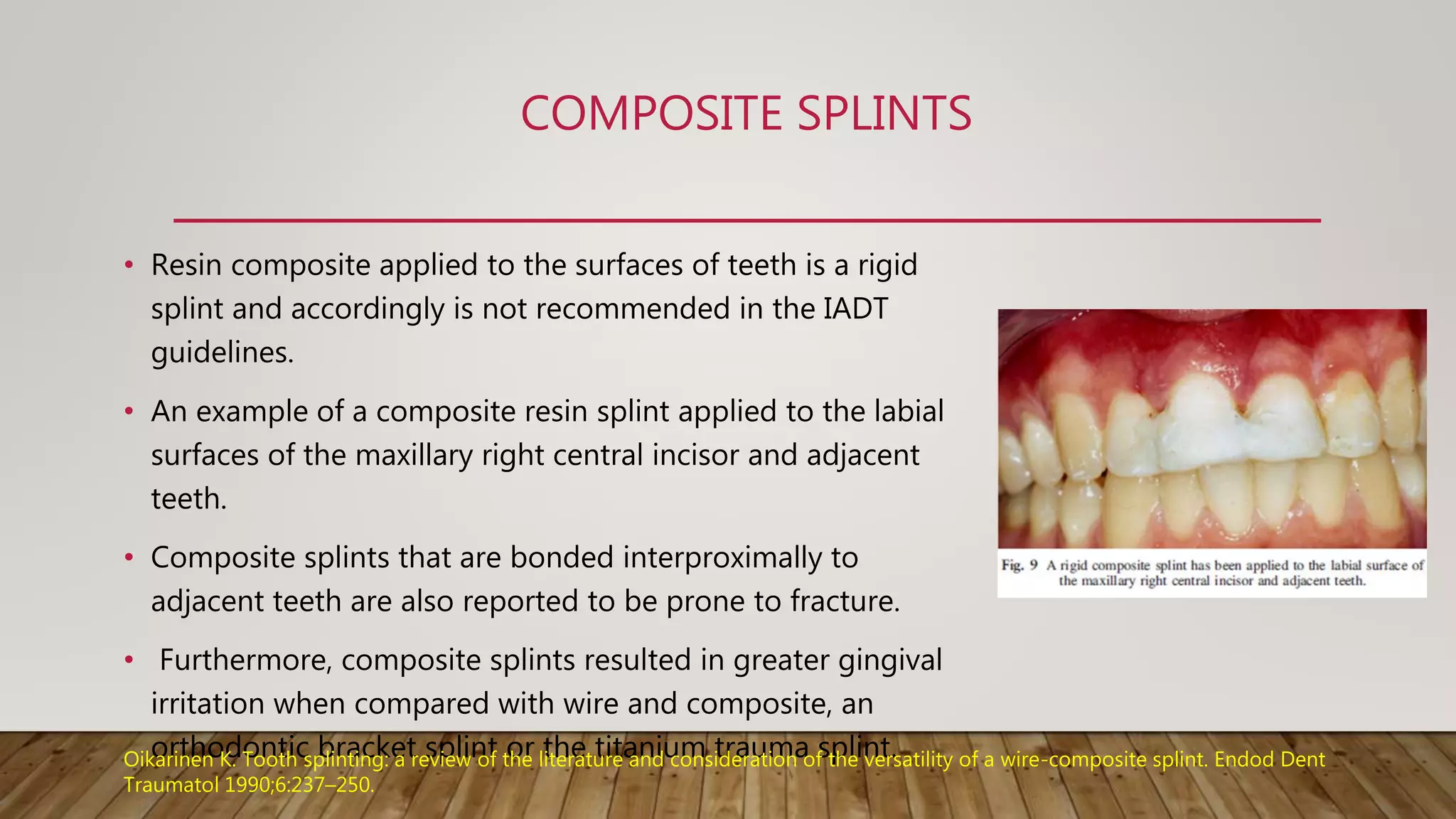 Splinting of traumatized teeth | PPTX