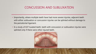 Splinting of traumatized teeth | PPTX
