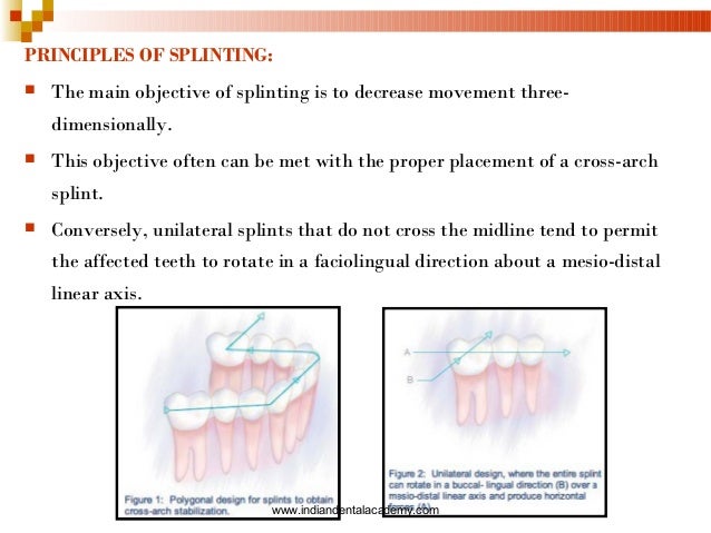 Splinting part i /certified fixed orthodontic courses by Indian denta…