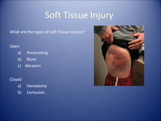 Splinting and Sports Injuries CME 2007 | PPT