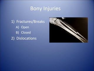 Splinting and Sports Injuries CME 2007 | PPT
