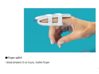 Different Splinting Techniques of Fractures.pptx