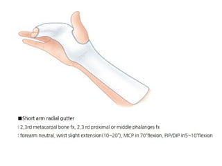 Different Splinting Techniques of Fractures.pptx