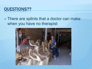 Splinting when you have no therapists | PPTX