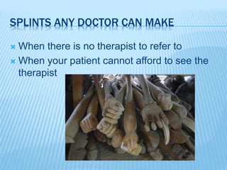 Splinting when you have no therapists | PPTX