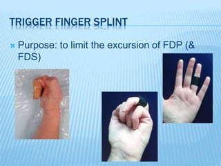 Splinting when you have no therapists | PPTX