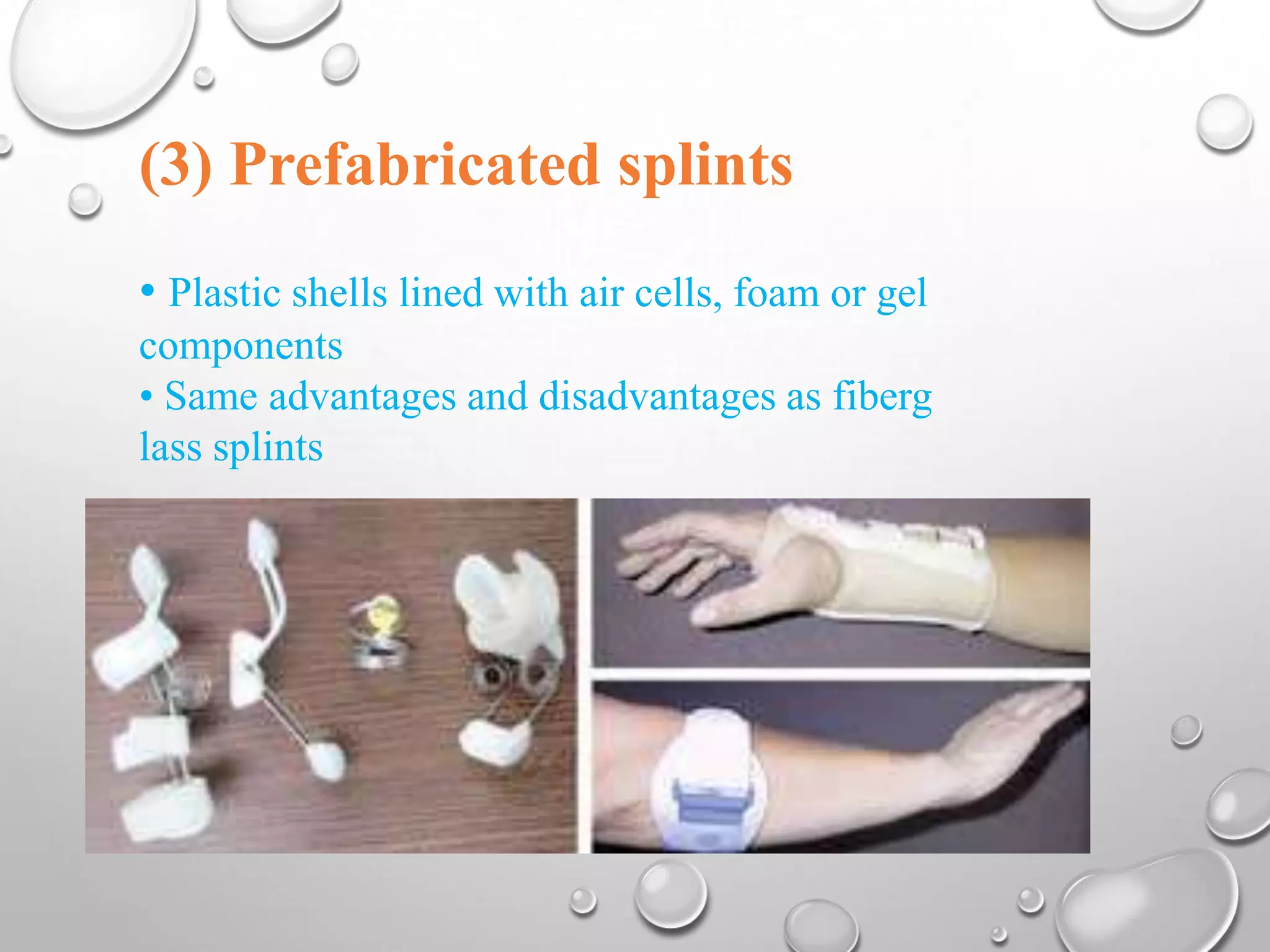 Splint ppt by rupeshkumar | PPTX