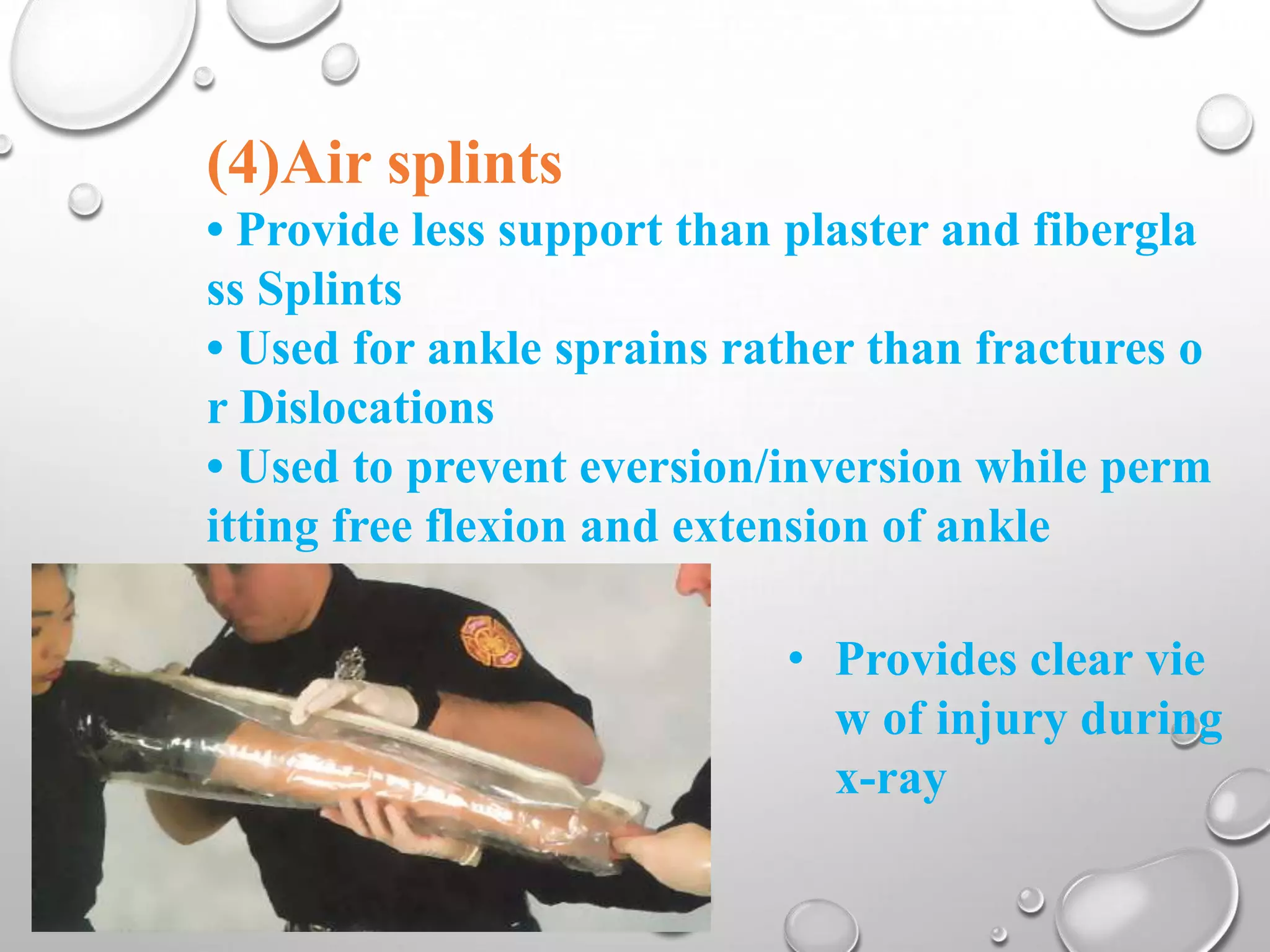 Splint ppt by rupeshkumar | PPTX