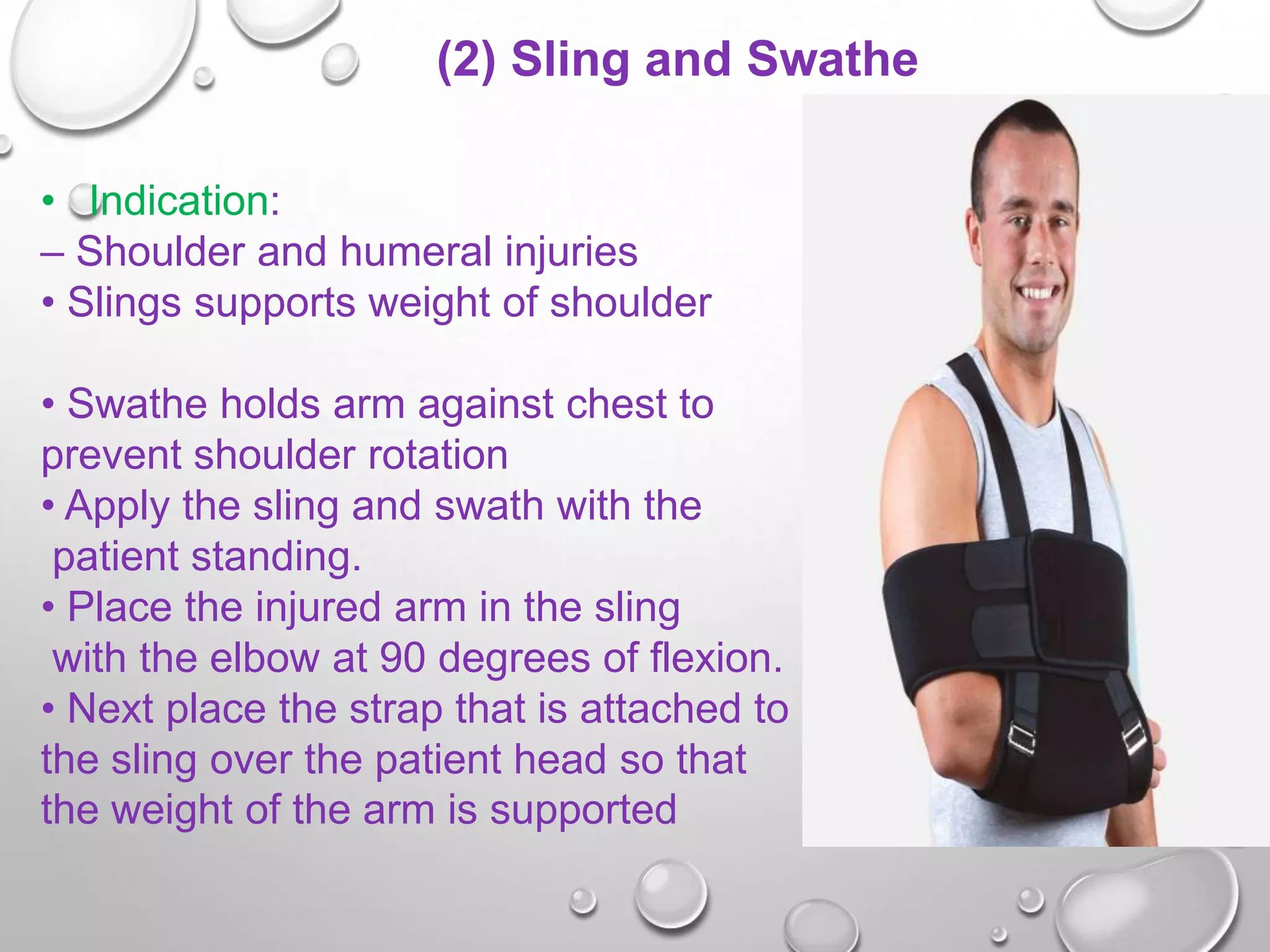 Splint ppt by rupeshkumar | PPTX