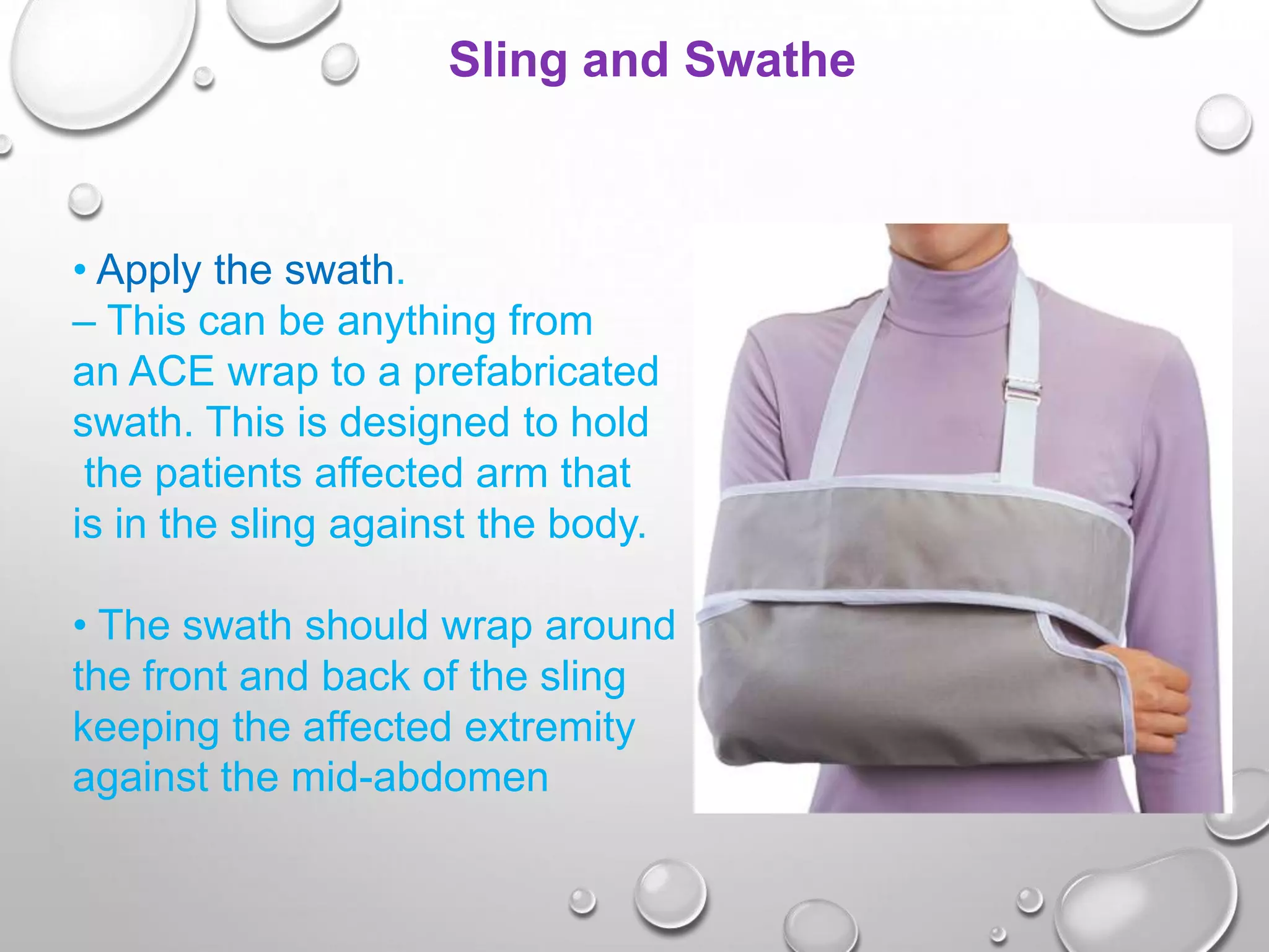 Splint ppt by rupeshkumar | PPTX