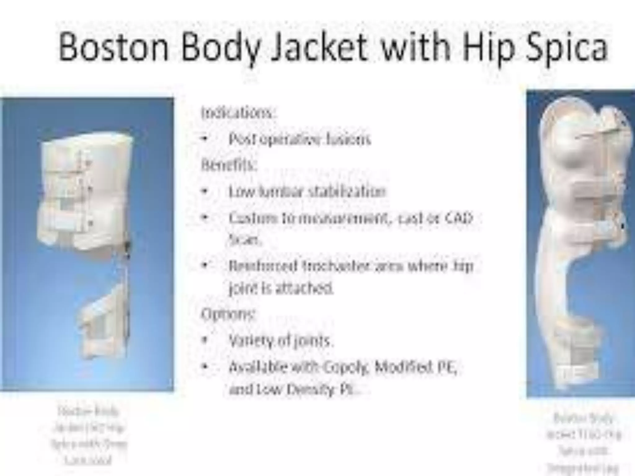 Splint ppt by rupeshkumar | PPTX