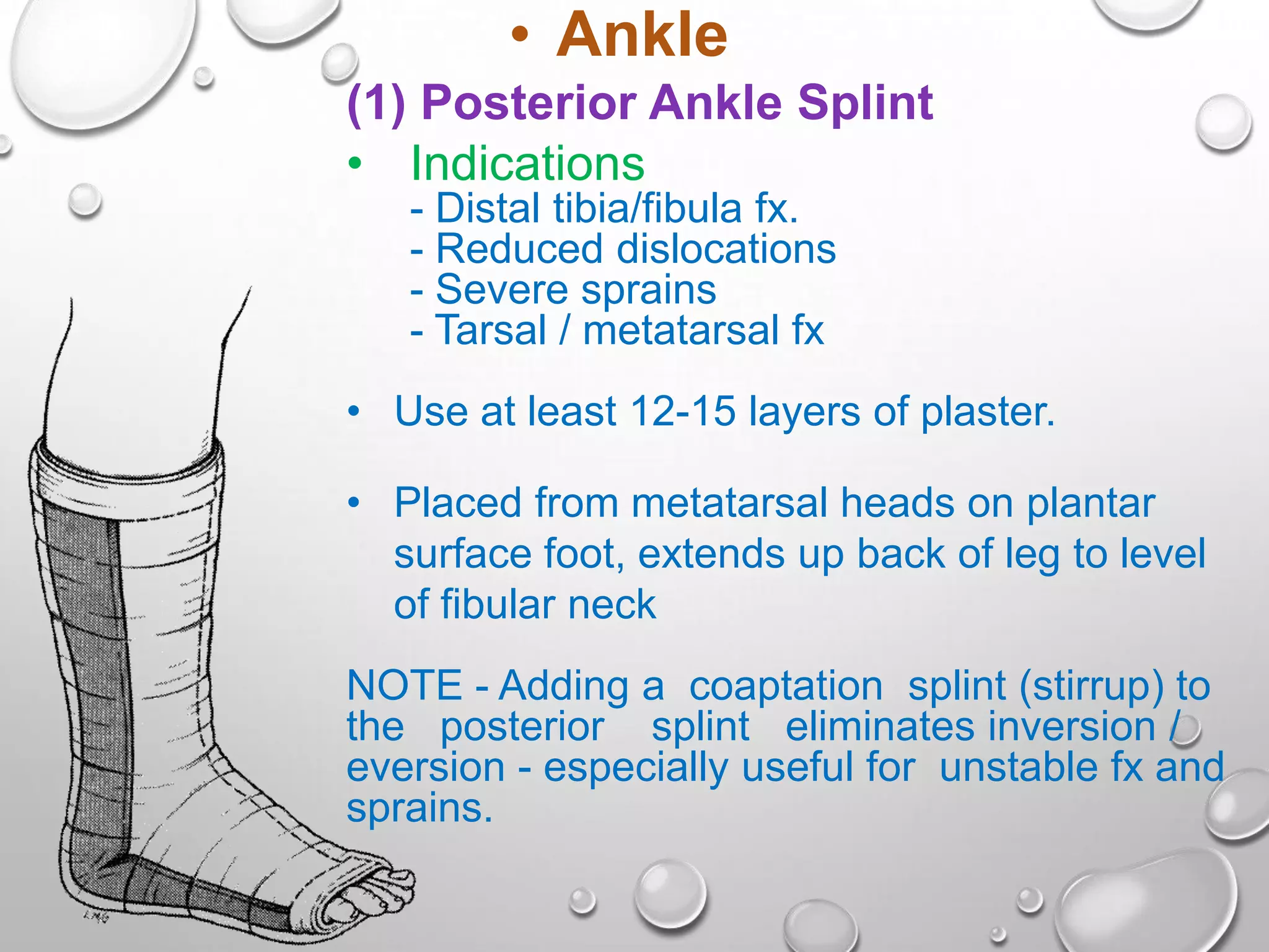 Splint ppt by rupeshkumar | PPTX