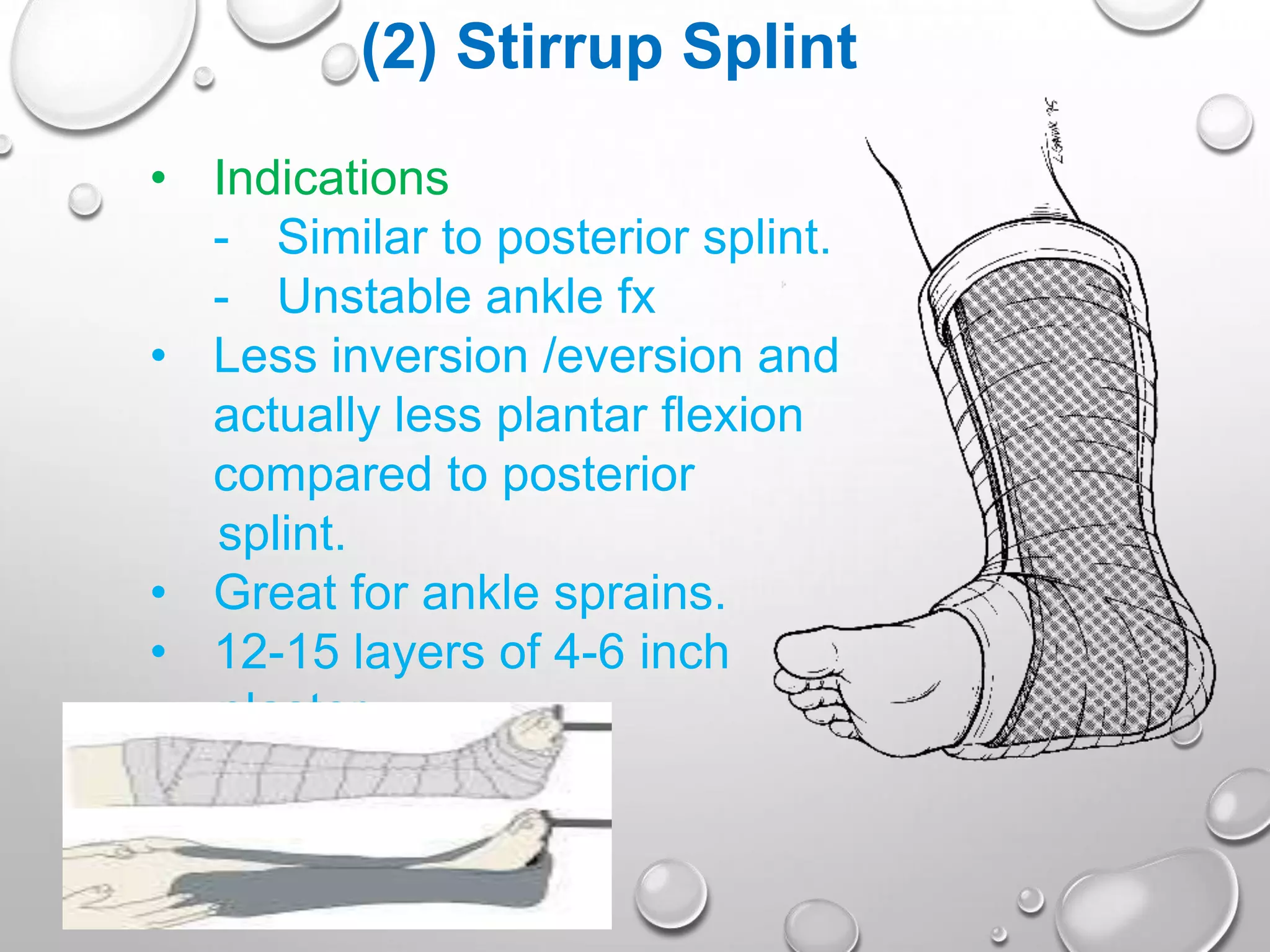 Splint ppt by rupeshkumar | PPTX