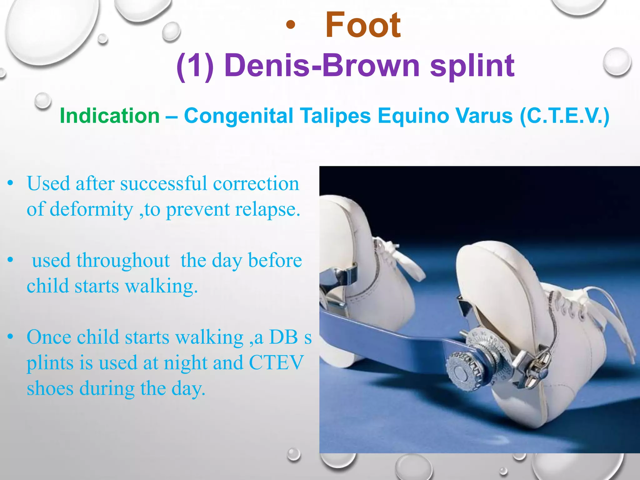 Splint ppt by rupeshkumar | PPTX
