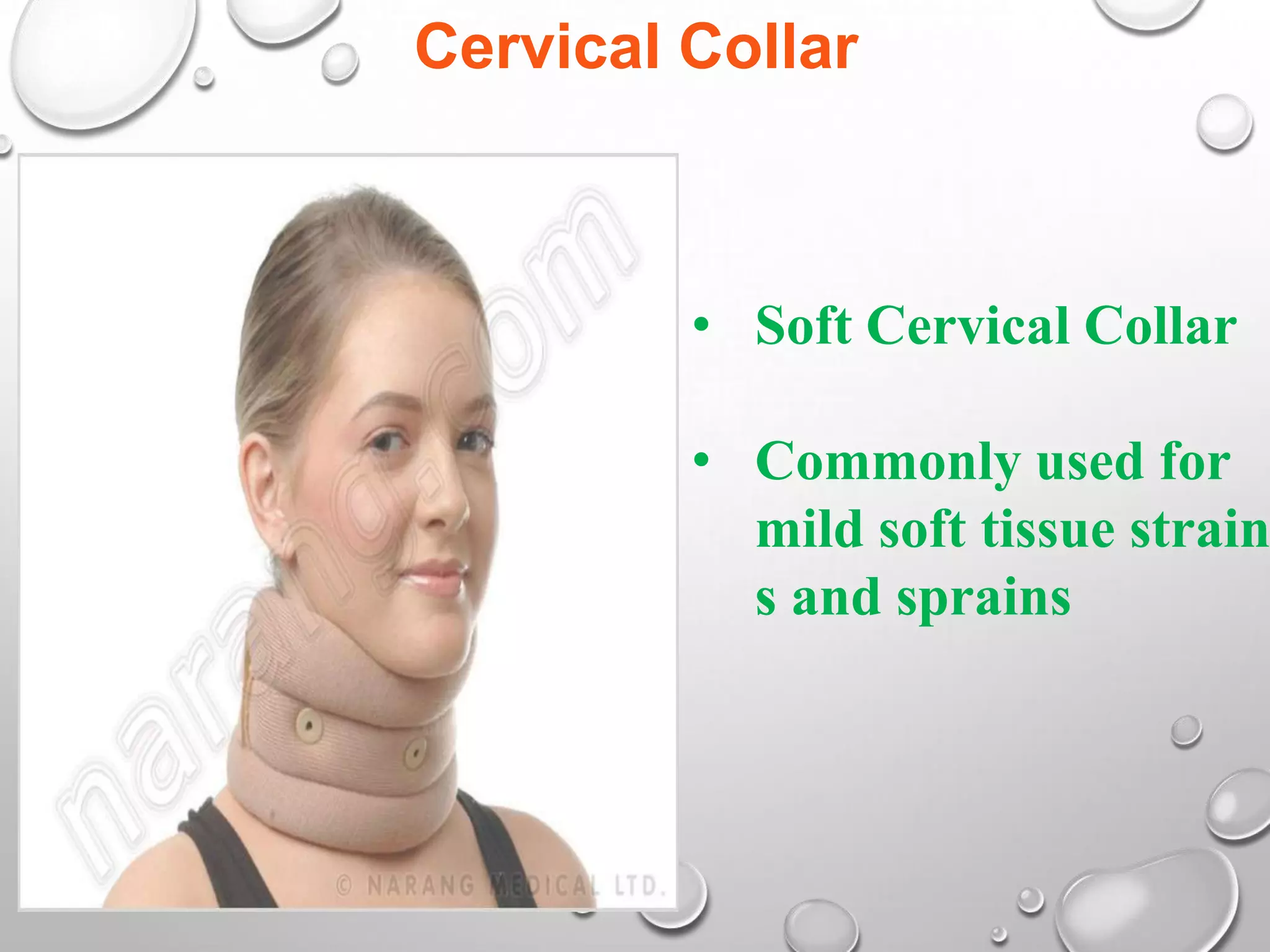 Splint ppt by rupeshkumar | PPTX