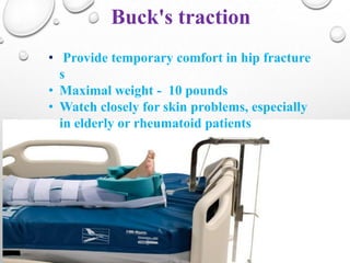 Splint ppt by rupeshkumar | PPTX