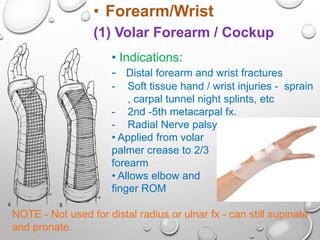 Radial Gutter Splint Pattern