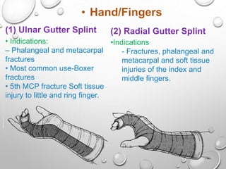 Radial Gutter Splint Pattern