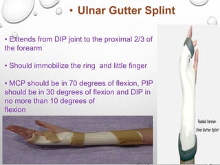 Ulnar Gutter Splint Procedure