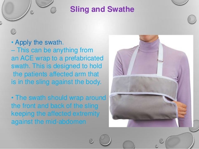 Splint ppt by rupeshkumar