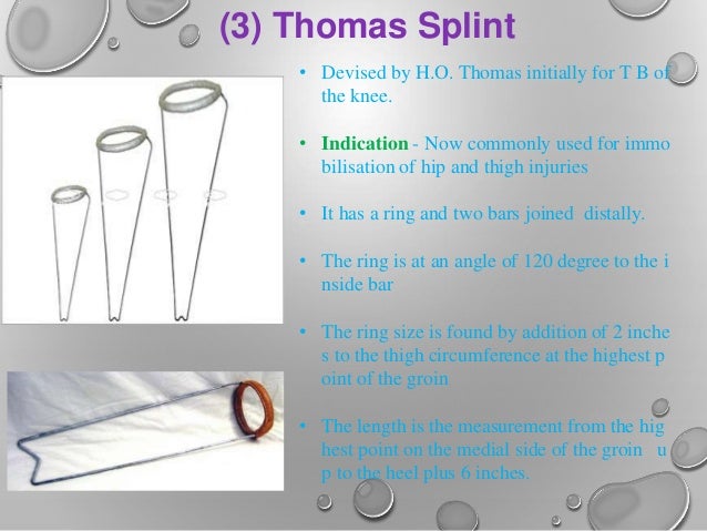 Splint ppt by rupeshkumar