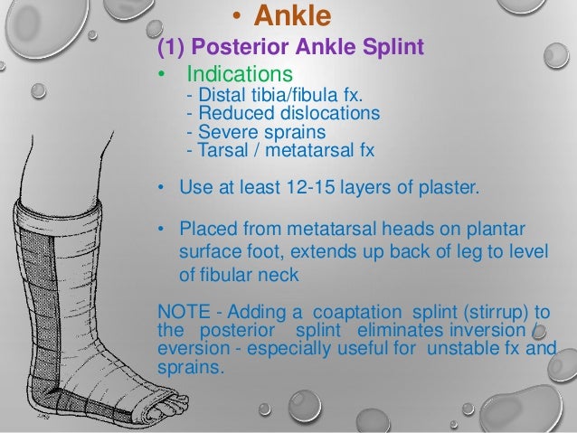 Splint ppt by rupeshkumar