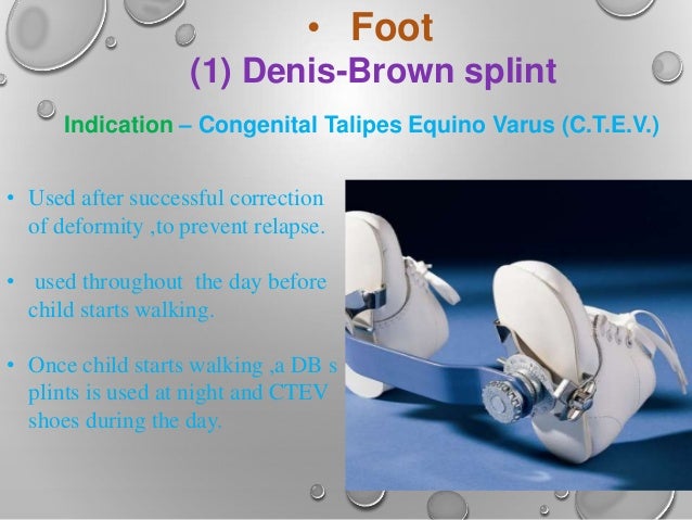Denis Browne Splint JRCO DENIS BROWNE SPLINT