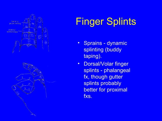 Splints | PPT