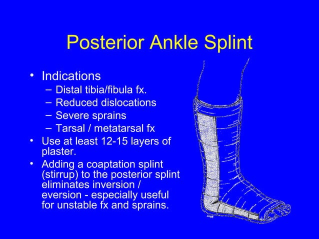 Splints | PPT