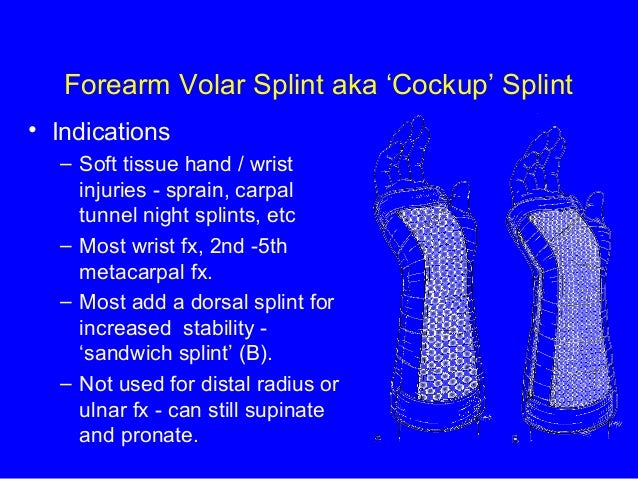 Splints