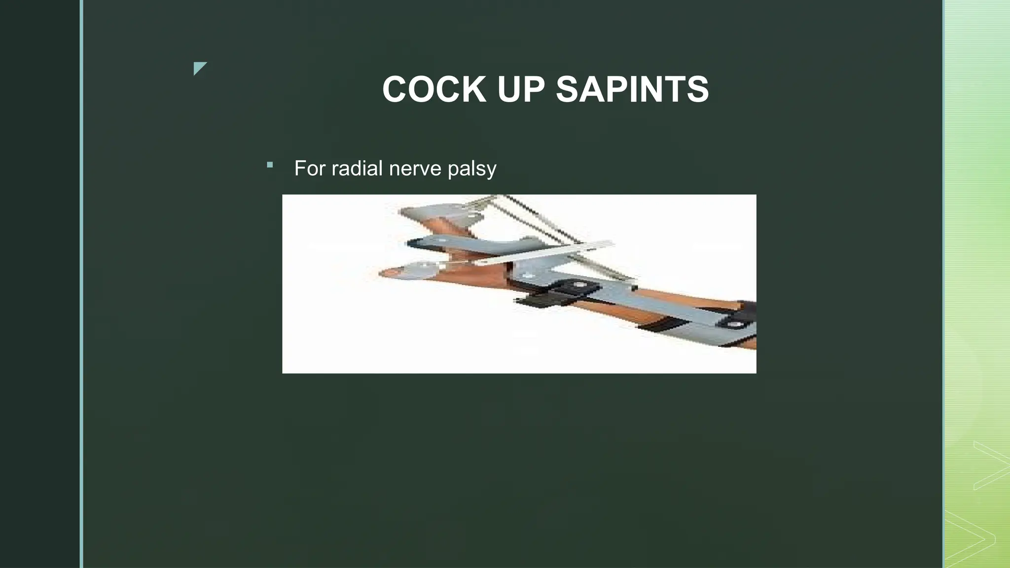 Various types of splints and basic PPT.. | PPT | Free Download