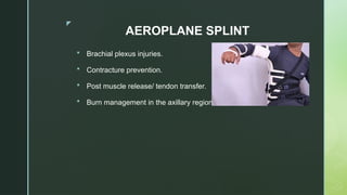 Various types of splints and basic PPT.. | PPT | Free Download