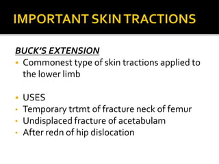 Splints and tractions | PPTX