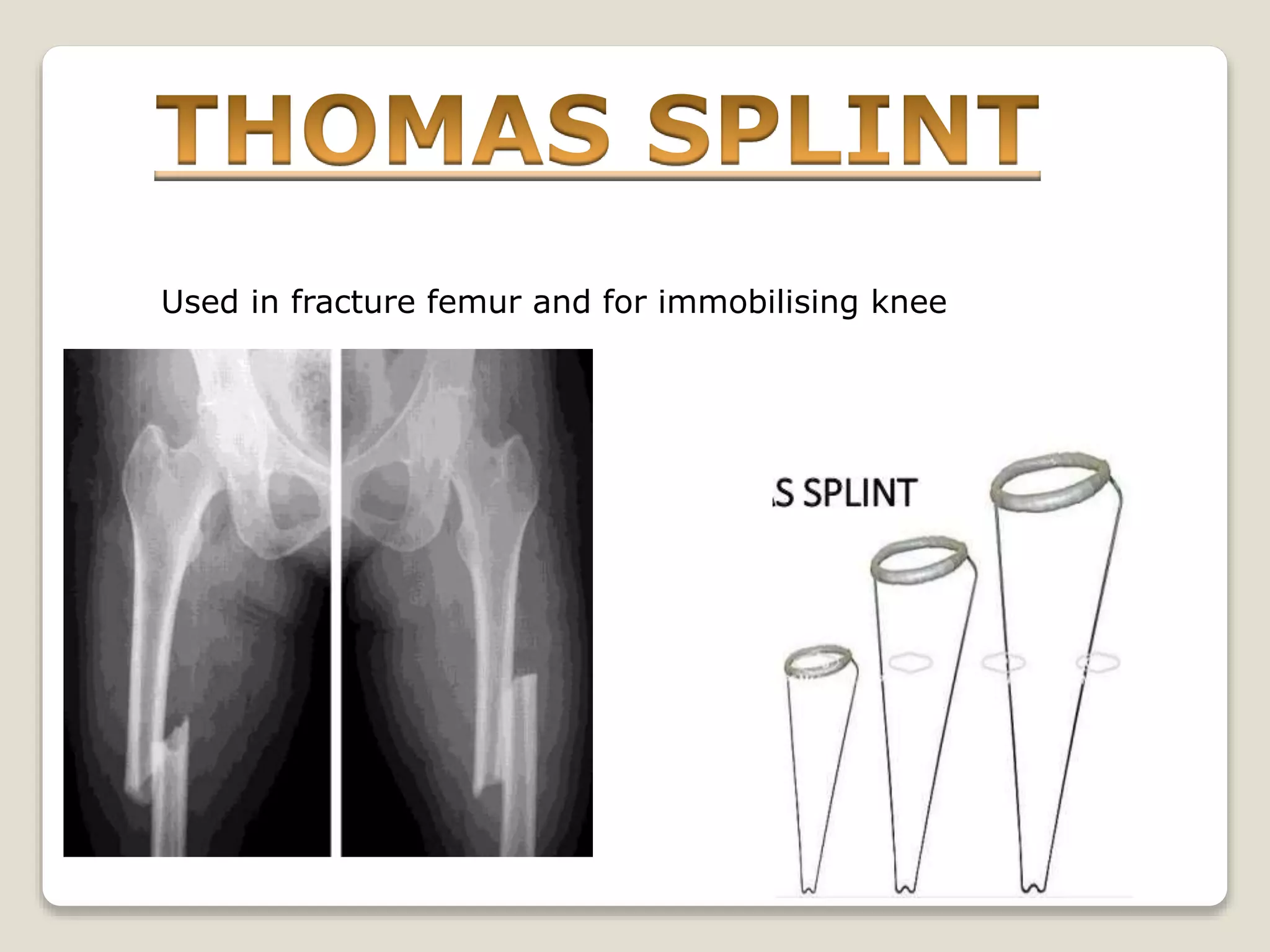 Splints and tractions | PPT