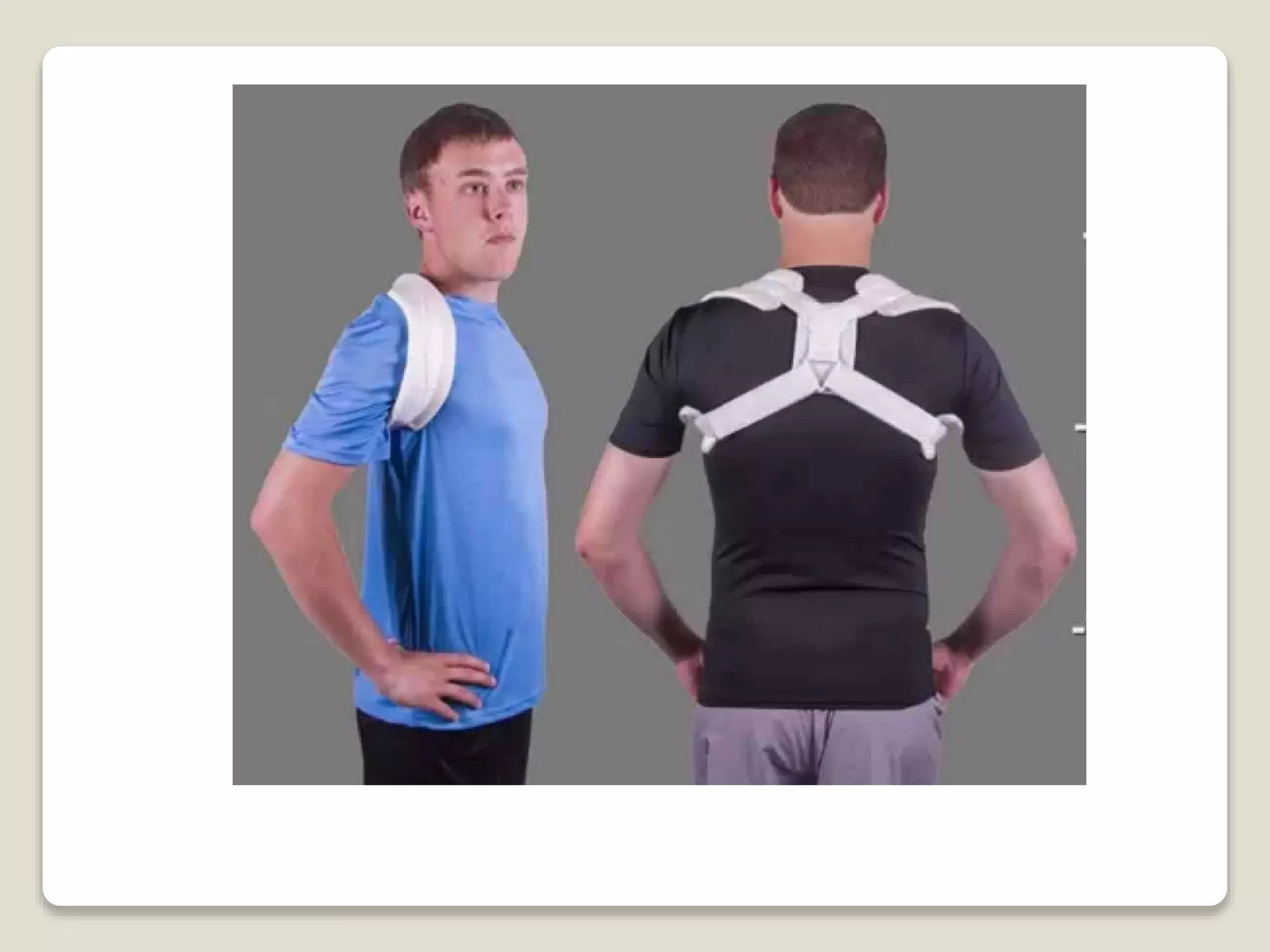 Splints and tractions | PPT