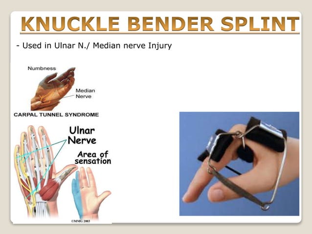 Splints and tractions | PPT
