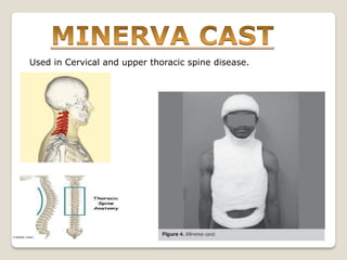 Minerva Cast