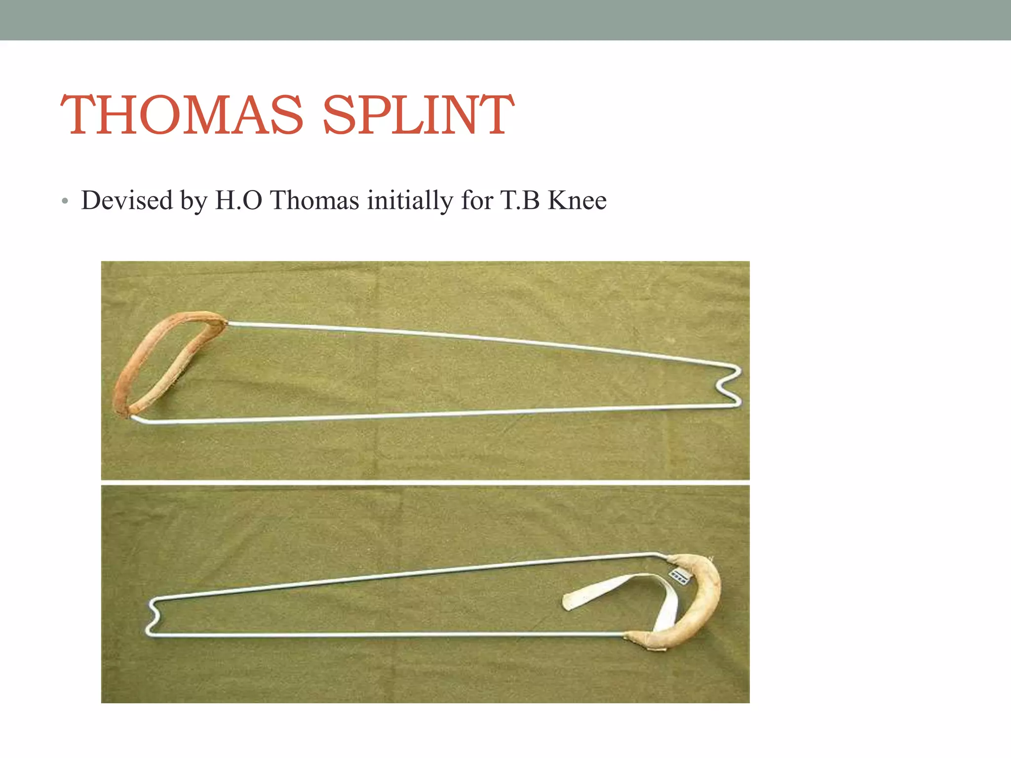 Splints and tractions | PPTX